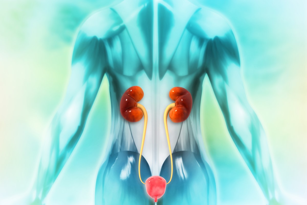 Virtsanpidätys: mitä on anuria, tukos ja virtsanpidätys? - Oire ...